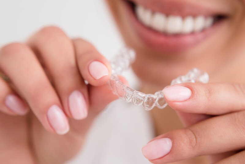 Invisalign San Jose | Clear Aligners | Butterfly Dental Care